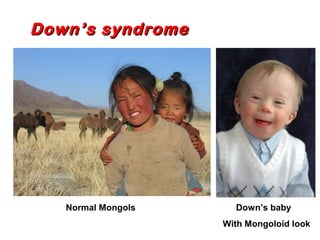 Numerical structuralabnormalities csbrp | PPT