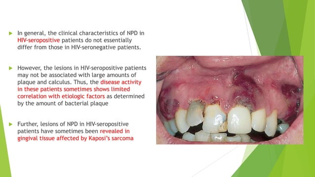 Necrotizing Periodontal Diseases – PFJQ