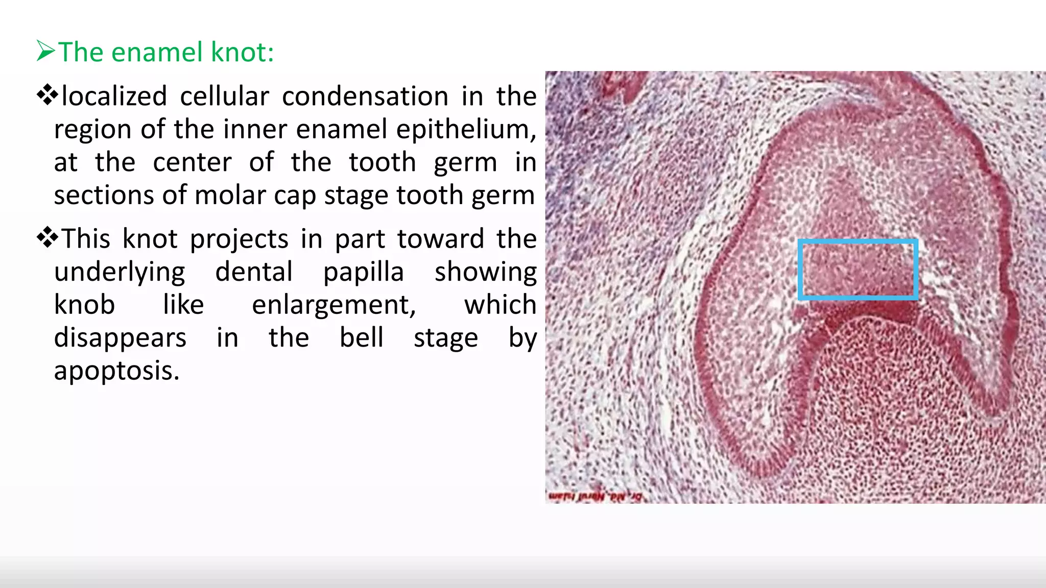 Tooth development 1 | PPTX
