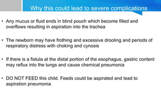 Omphalocele/Exomphalos, cleft palate & Oesophageal atresia and Nursing ...