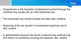 Omphalocele/Exomphalos, cleft palate & Oesophageal atresia and Nursing ...