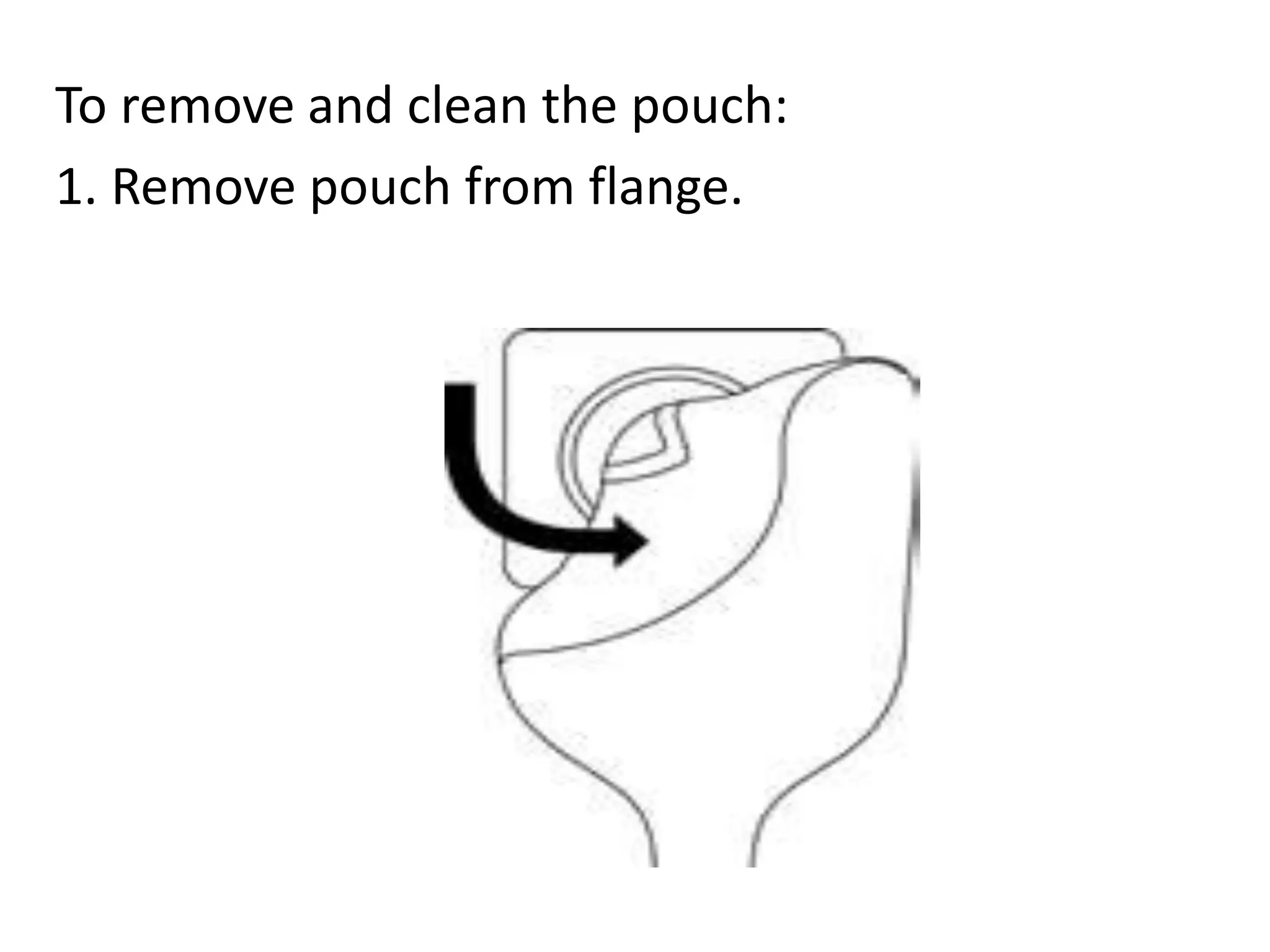 Nursing Care for Colostomy | PPTX