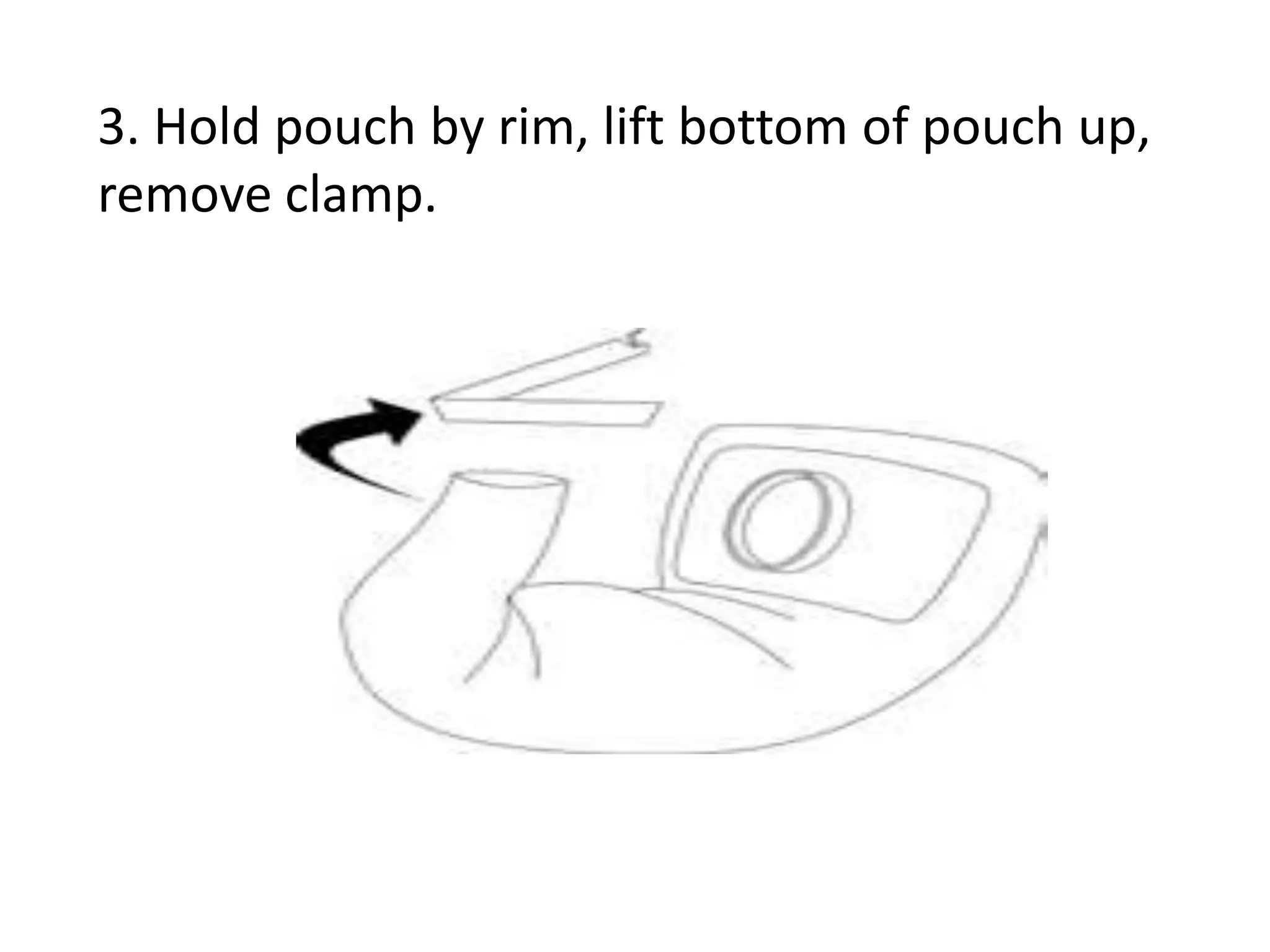 Nursing Care for Colostomy | PPTX