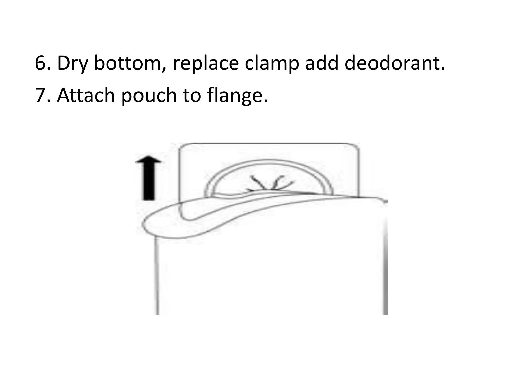 Nursing Care for Colostomy | PPTX