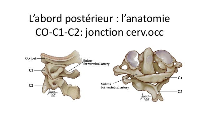 Nurse Spinal Course Abord postérieur de la colonne cervicale