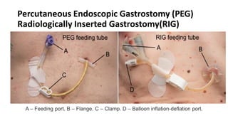 Nurse's role- nutrition of Patient with Stroke.pdf