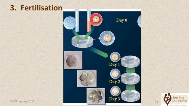 Nurses Webinar - Role of Fertility Nurse | PPT