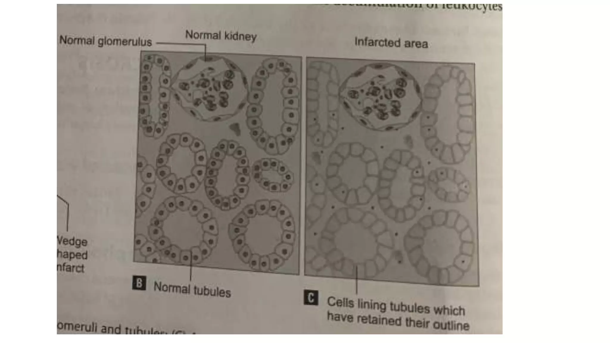 Cell adaptations, Cell injury, Necrosis, Apoptosis - Pathology ...