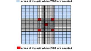 Hemoglobin estimation, RBC, WBC, platelet counts - Pathology - Nursing ...