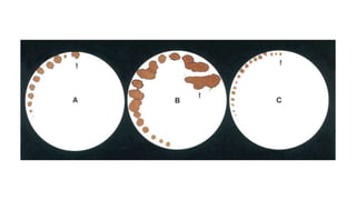 BT, CT, PT, INR - Pathology - Nursing | PPTX