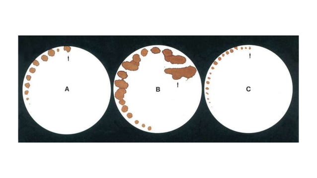 BT, CT, PT, INR - Pathology - Nursing | PPTX