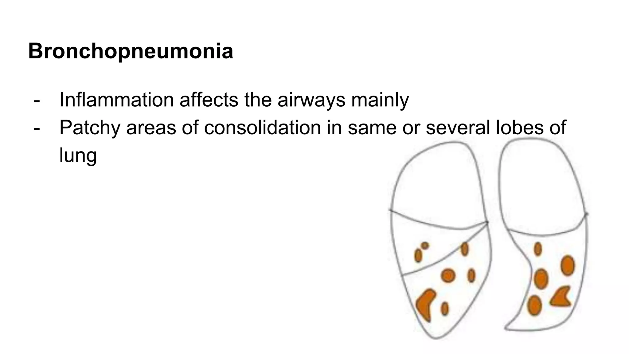 Bronchitis, Pneumonia - Pathology - Nursing | PPTX