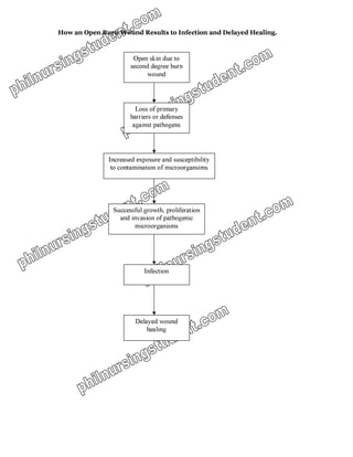 Nursing case-study-burns-philnursingstudent | PDF