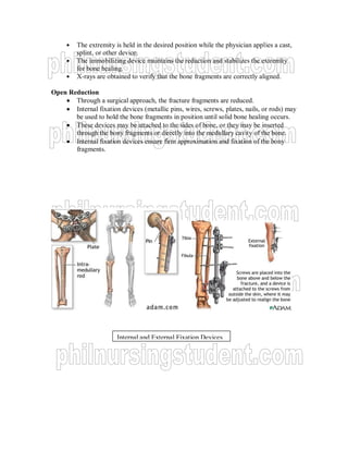 Nursing case-study-musculoskeletal-philnursingstudent ...