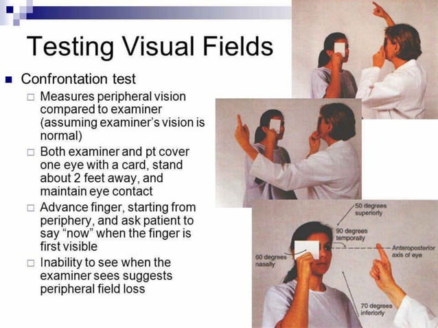 Nursing assessment and assessment of eye | PDF