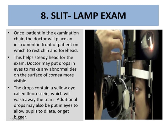 Nursing assessment and assessment of eye | PDF