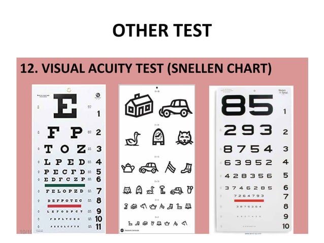 Nursing Assessment And Assessment Of Eye nursing-assessment-and-assessment-of-eye