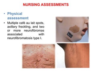 nursing assessment of cancer.pptx
