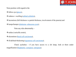 Nursing assessment of the eye | PPTX
