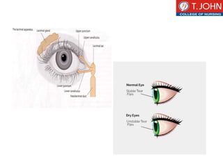 Nursing assessment of the eye | PPTX