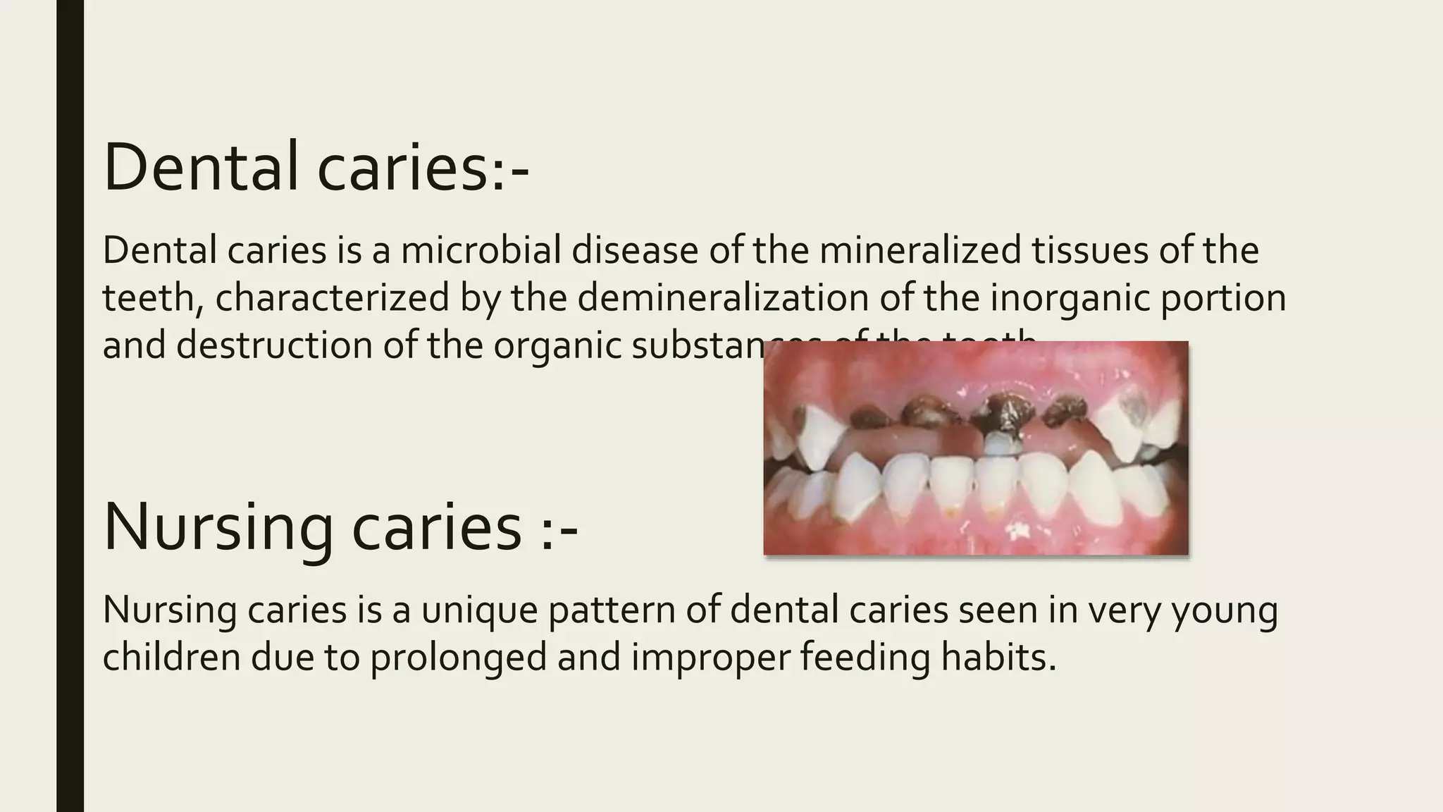 Nursing bottle caries.pptx