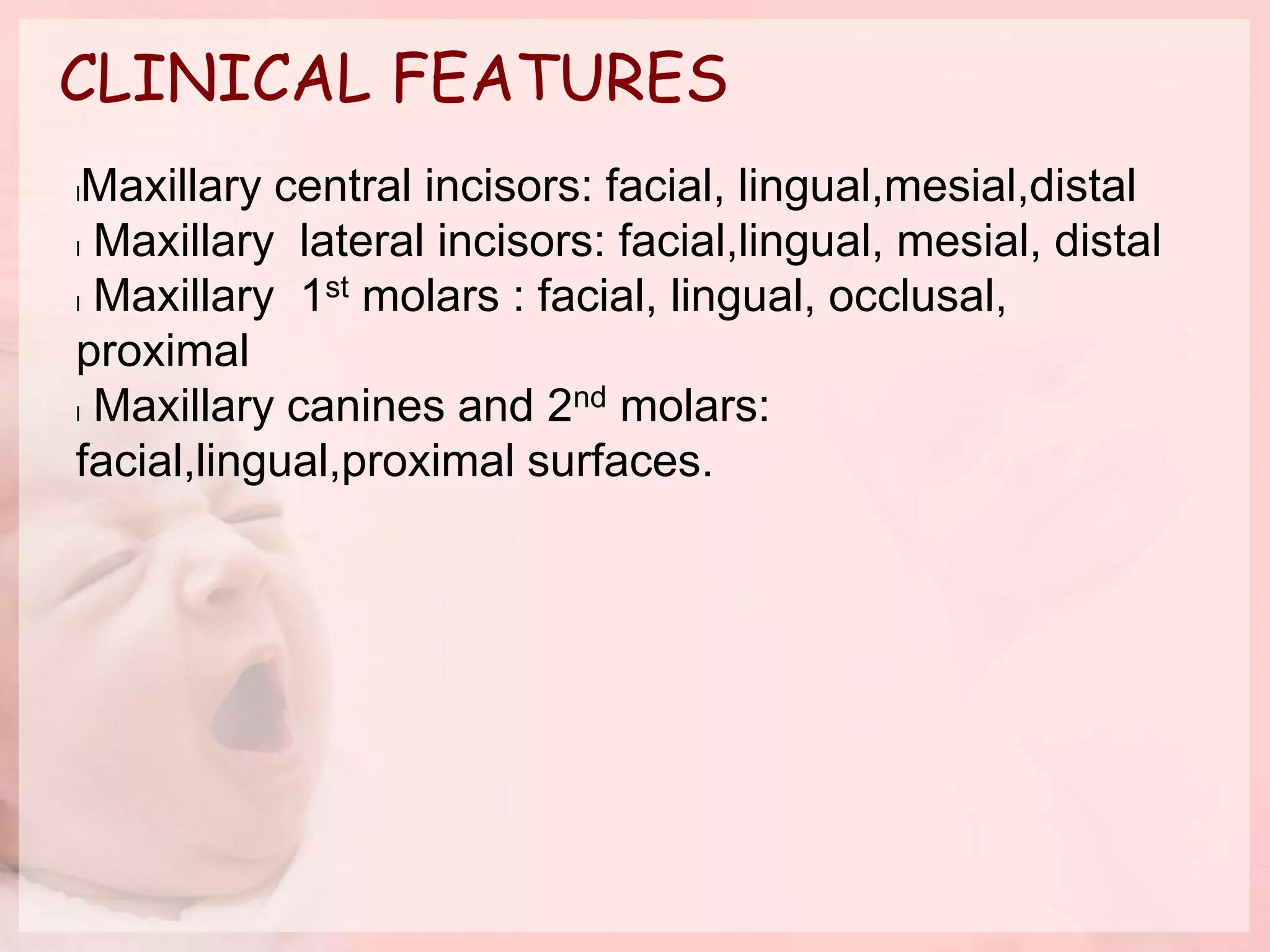 Nursing bottle caries and rampant caries | PPTX