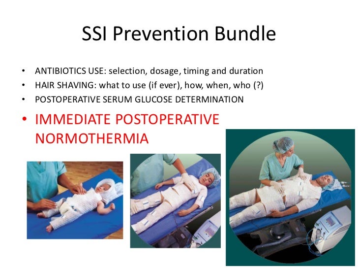 Superbugs and Bundles of Care