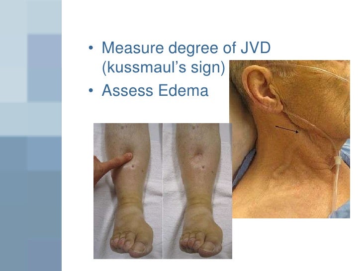 Blog Archives - Loveseat