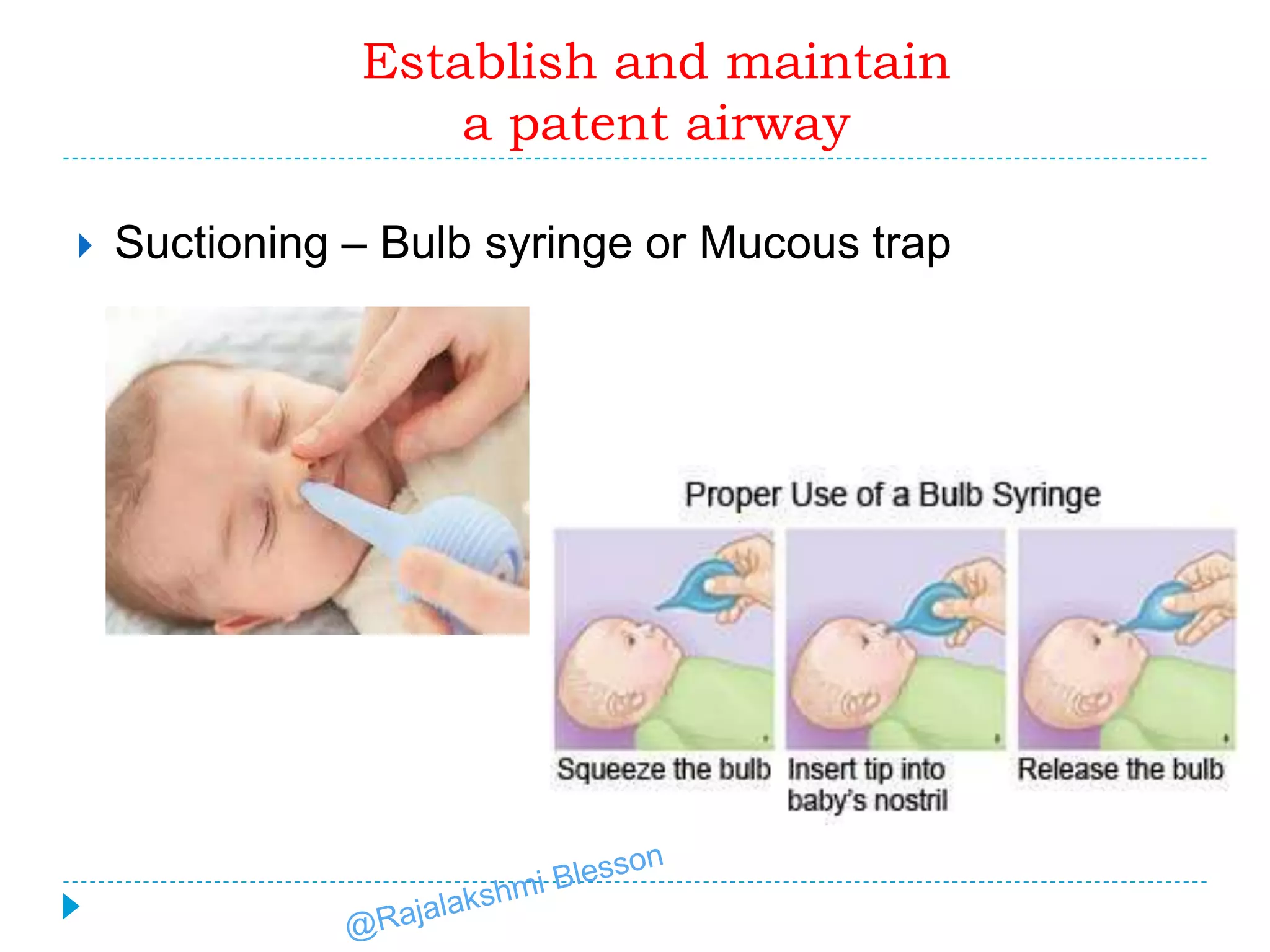 Nursing care of a normal newborn.pptx