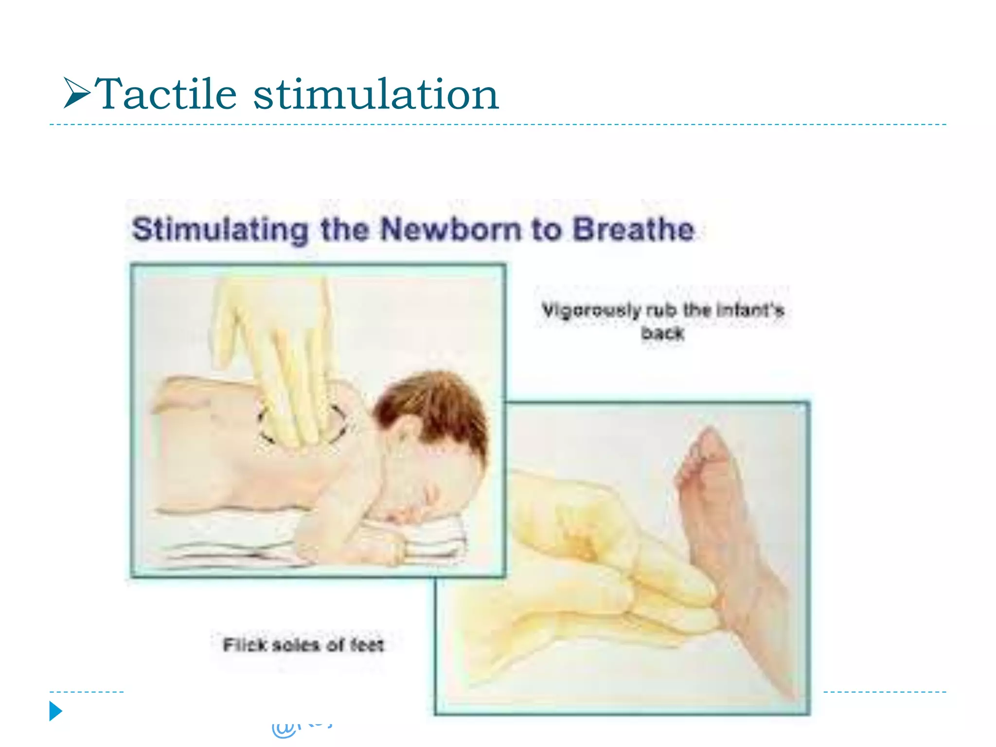 Nursing care of a normal newborn.pptx