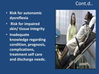 Nursing care of spinal cord injury | PPTX