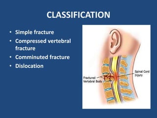 Nursing care of spinal cord injury | PPTX