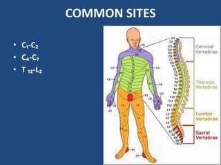 Nursing care of spinal cord injury | PPTX