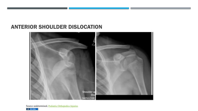 NURSING CARE PATIENT WITH DISLOCATION.pptx