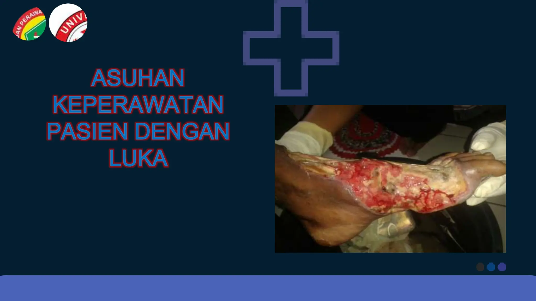 NURSING CARE PLAN FOR PATIENTS WITH WOUNDS.ppt