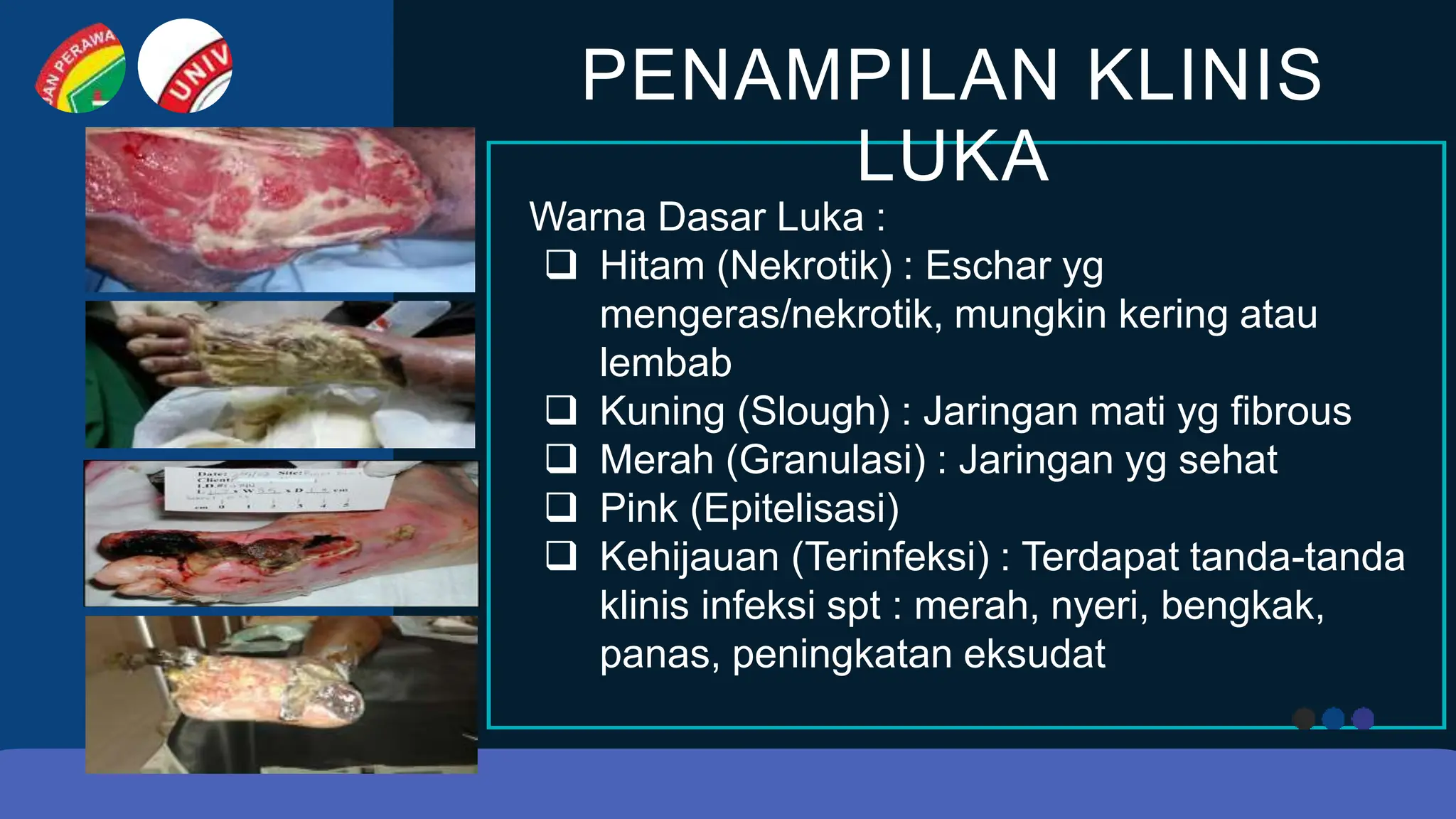 NURSING CARE PLAN FOR PATIENTS WITH WOUNDS.ppt