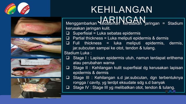 NURSING CARE PLAN FOR PATIENTS WITH WOUNDS.ppt