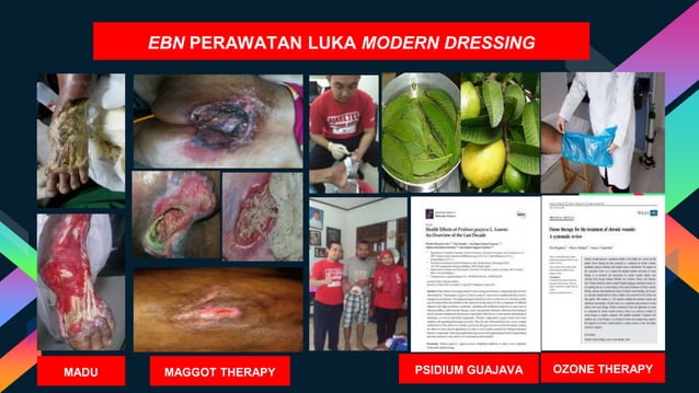 NURSING CARE PLAN FOR PATIENTS WITH WOUNDS.ppt