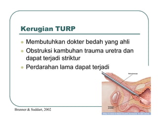 Nursing care process (askep) turp syndrome | PDF