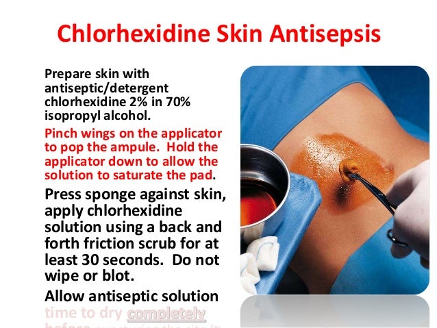 Intensive care Units Role of Nursing