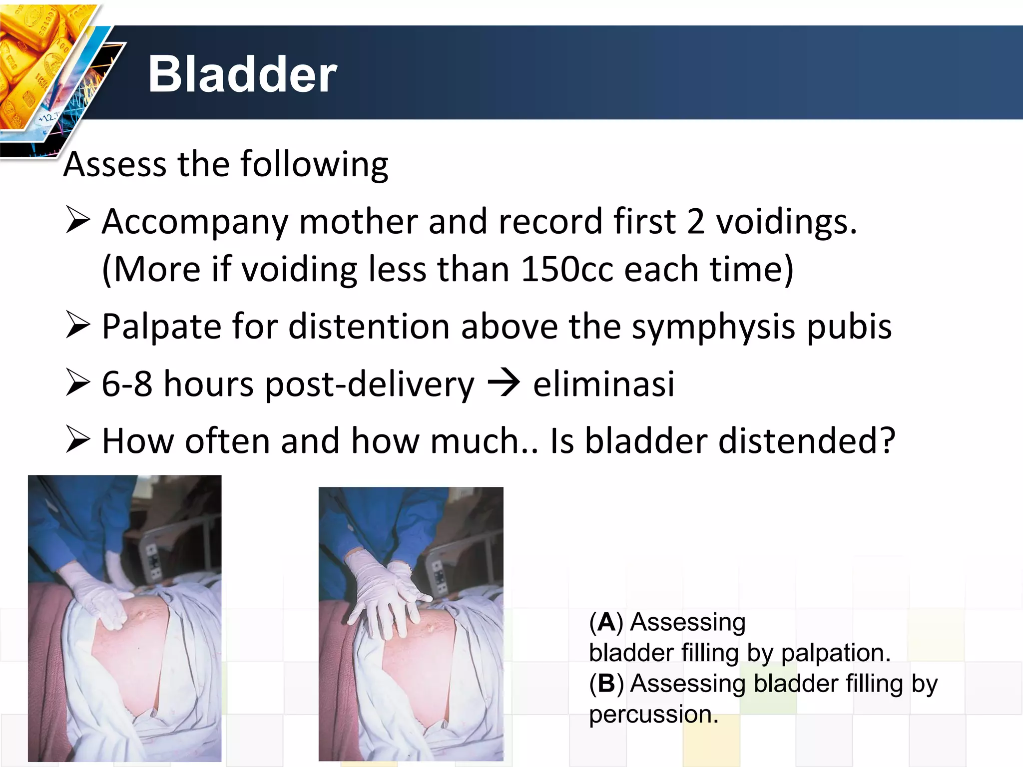 NURSING MANAGEMENT DURINGTHE POSTPARTUM PERIOD 2021.pdf