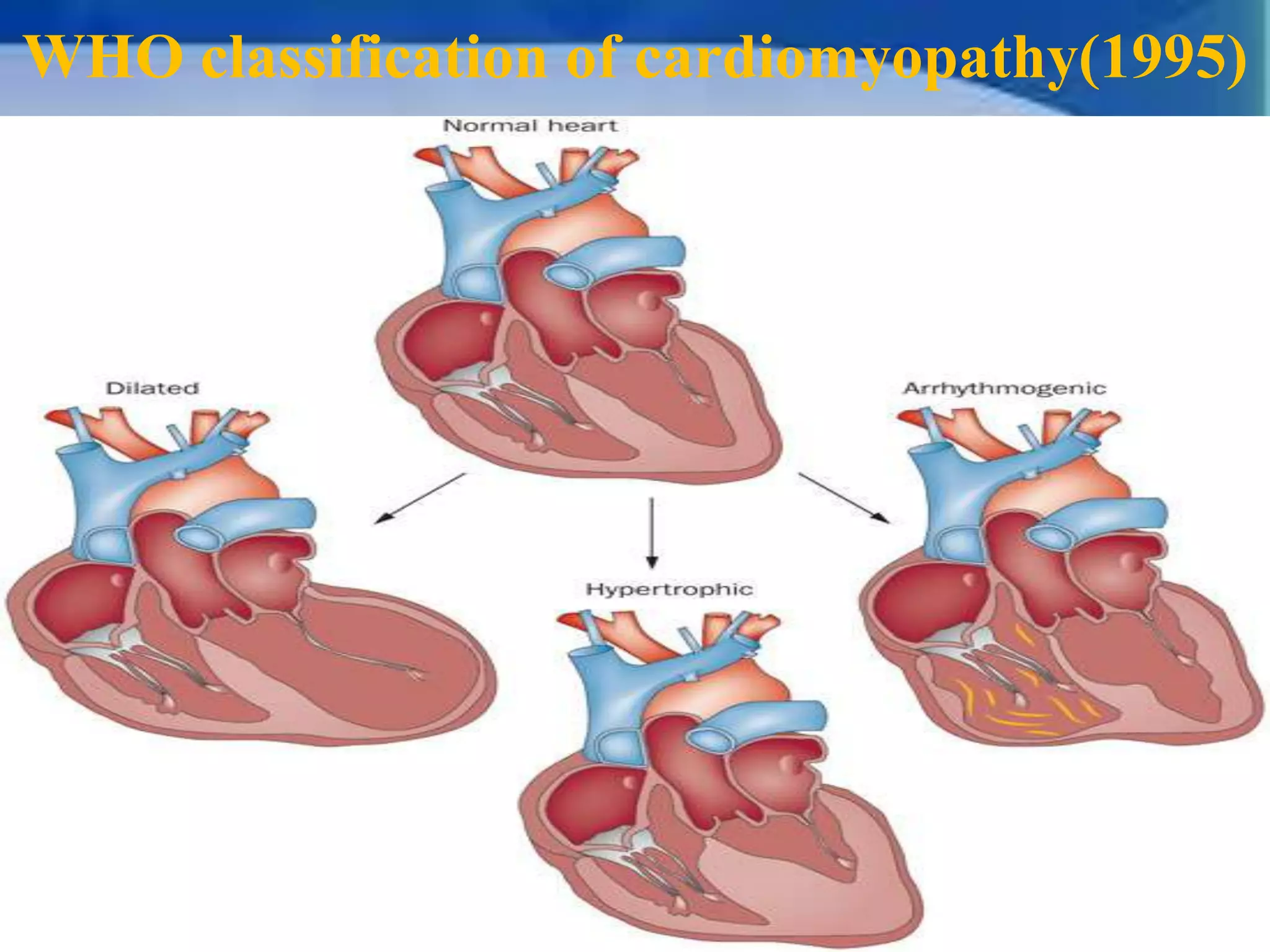 Nursing management of a patient with cardiomyopathy | PPTX