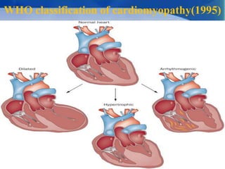 Nursing management of a patient with cardiomyopathy | PPTX