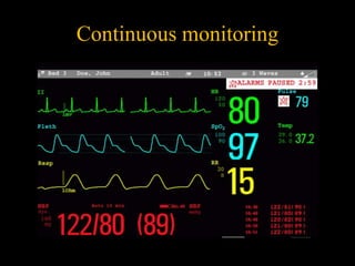 Nursing management of critically ill patient | PPTX