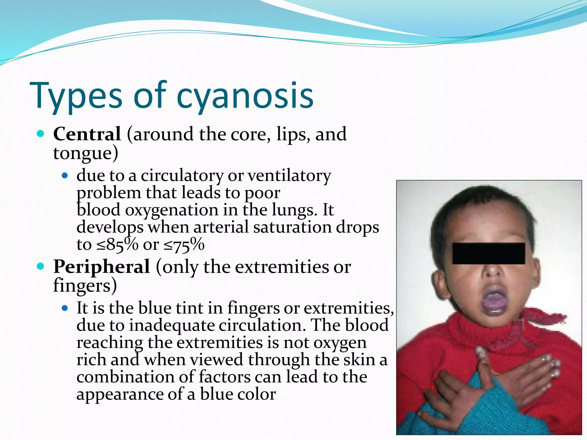 Nursing management of patients with oxygen insufficiency | PPTX