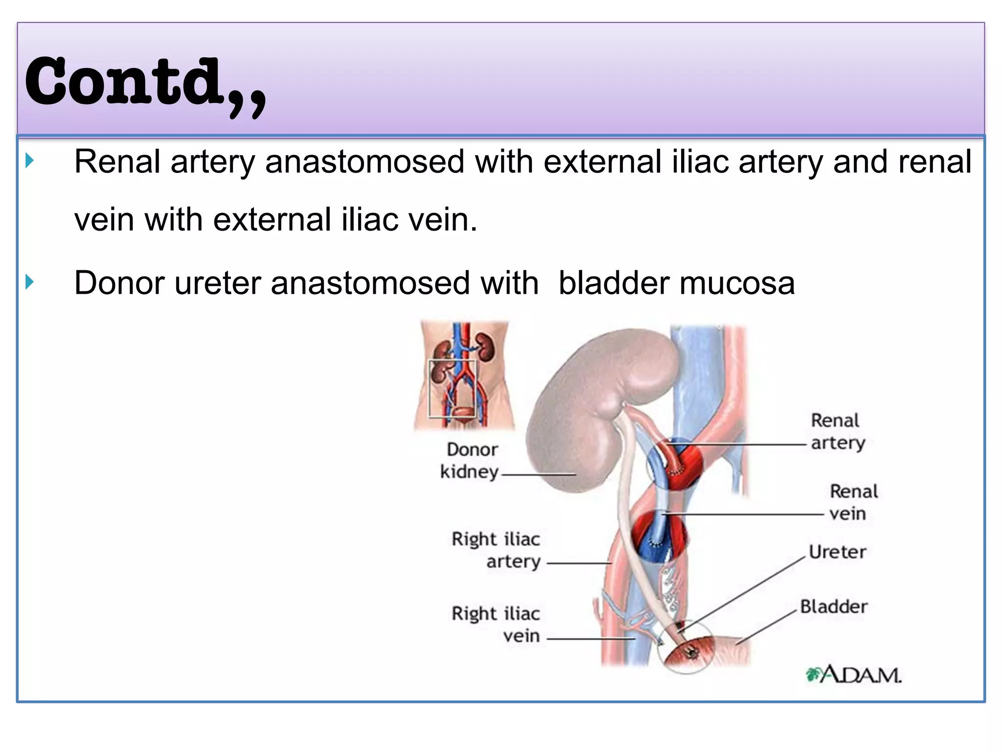 Nursing Management of patient undergoing renal transplantation.pdf