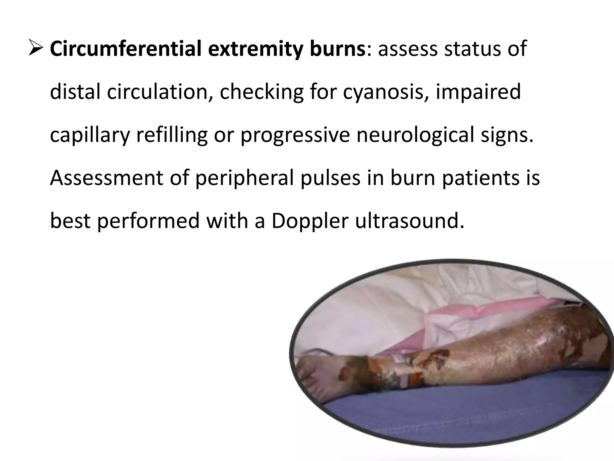 Nursing management of patient with Burns | PPTX