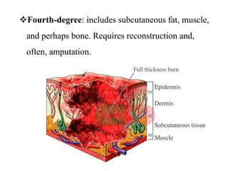 Fourth Degree Burn Diagram