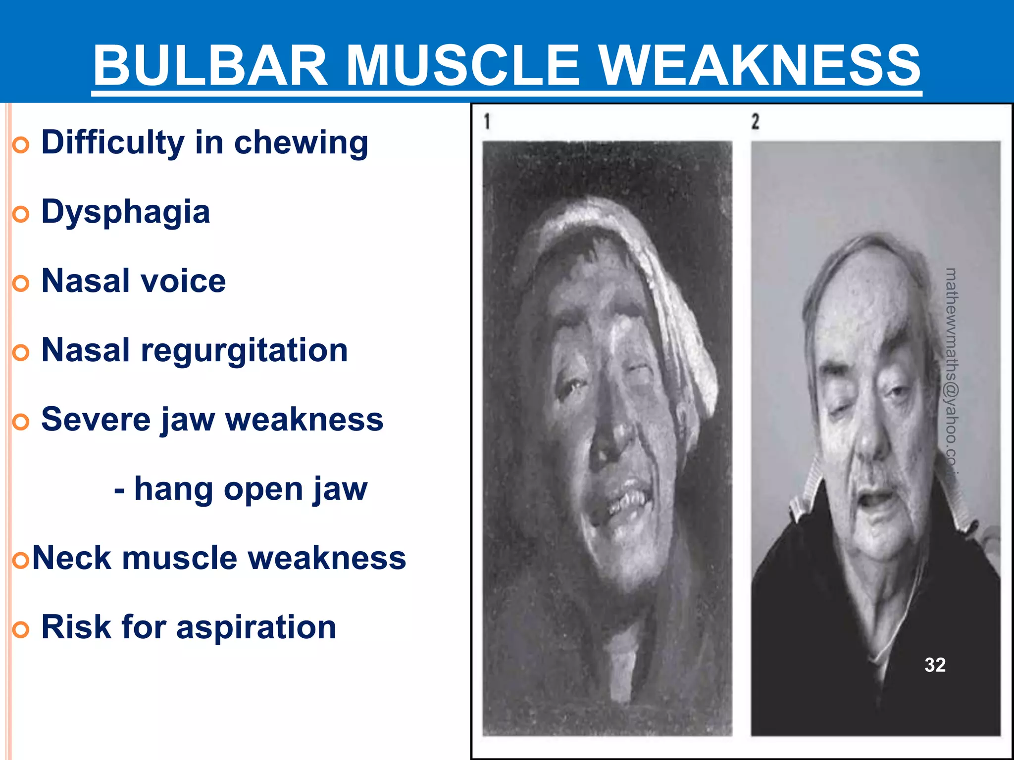 Nursing management of patient with chronic neurological problems | PPTX