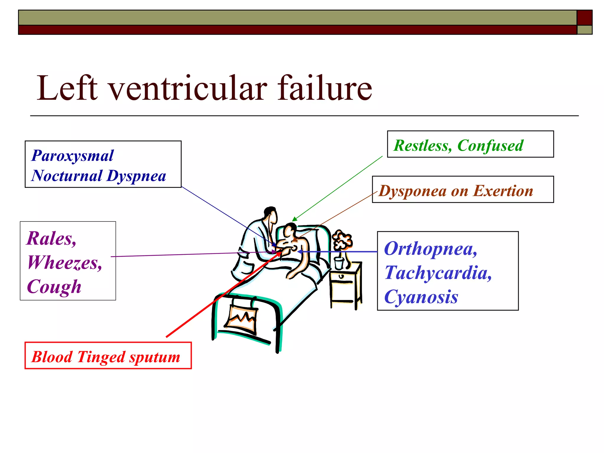 Nusing Management of CHF (English) Symposia | PPT